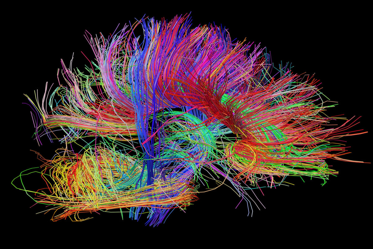 Come il cervello pensa: viaggio nel cervello - Dr. Matteo Mannucci ...